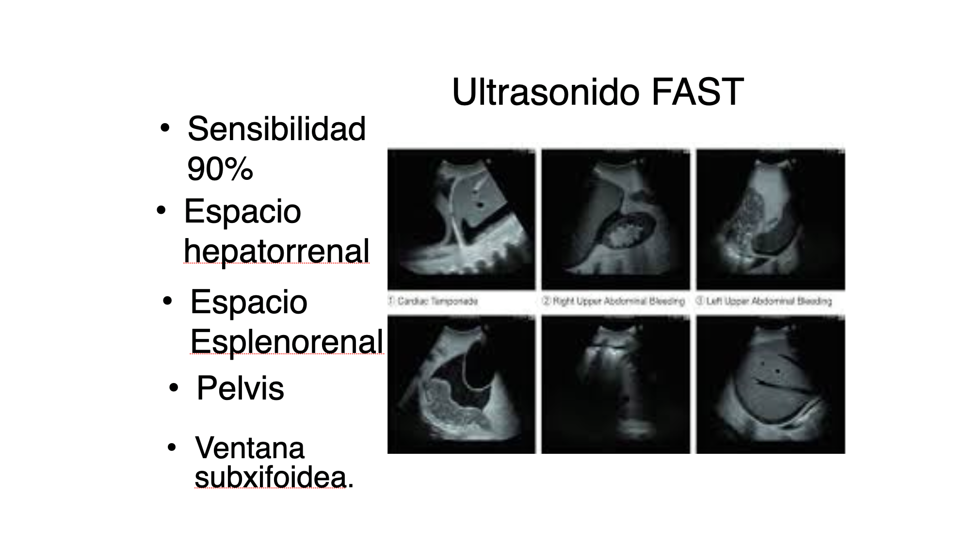 ZONA DE SALUD DE OFRA: Emergency Room Academy. Ultrasonido FAST en ...