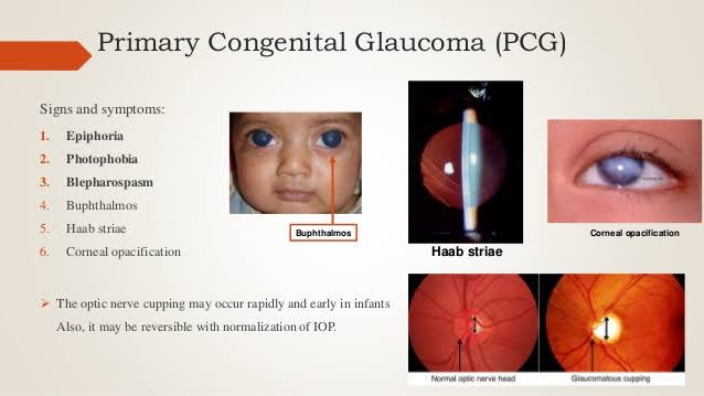 GLAUCOMA SPECIALIST BLOG: "THE GLOG"