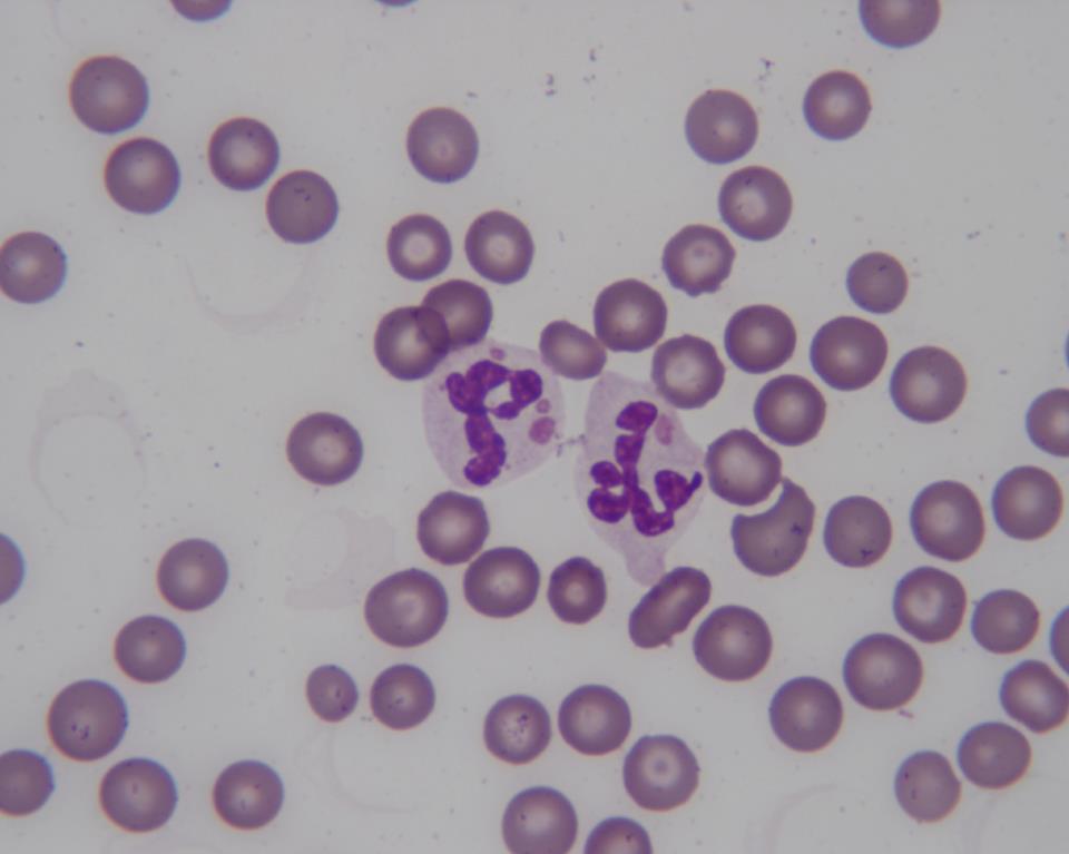 VETERINARY HEMATOLOGY DEXTERVET: distemper viral inclusions in a neutrophil