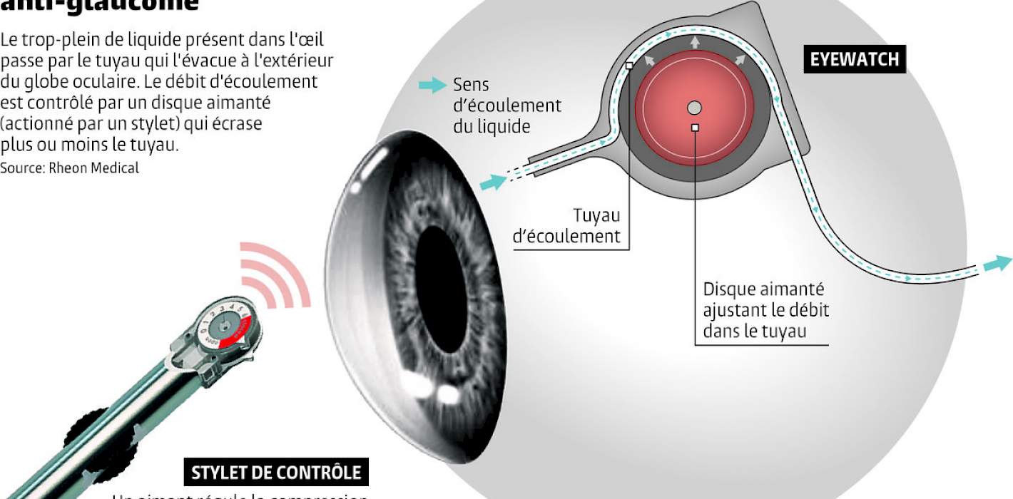 GLAUCOMA SPECIALIST BLOG: "THE GLOG"