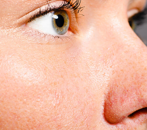 How to close the pores of the face | Meal Energy