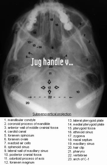 DOs and DONTs in DENTISTRY: SUBMENTOVERTICAL PROJECTION