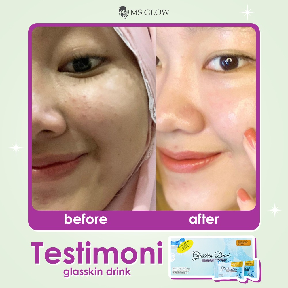 Reseller Resmi MS GLOW Skincare | Septa Ana