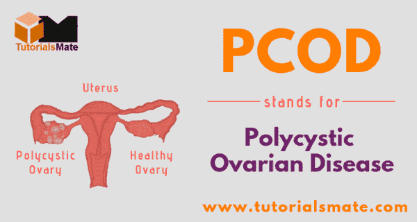 PCOD Full Form: What is the full form of PCOD? - TutorialsMate