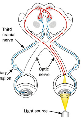 How to test for a relative afferent pupillary defect (RAPD)
