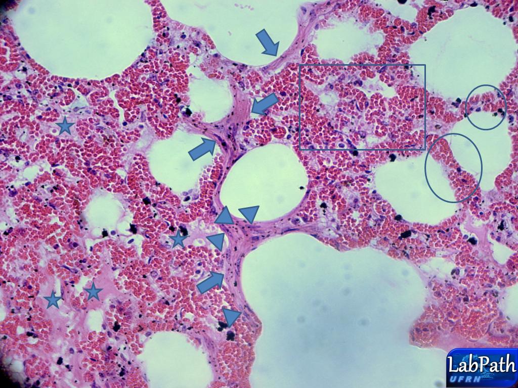 Laboratório Virtual de Patologia/Virtual Laboratory of Pathology ...