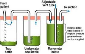 Water Seal Drainage (WSD) - Zahra_Sanjaya