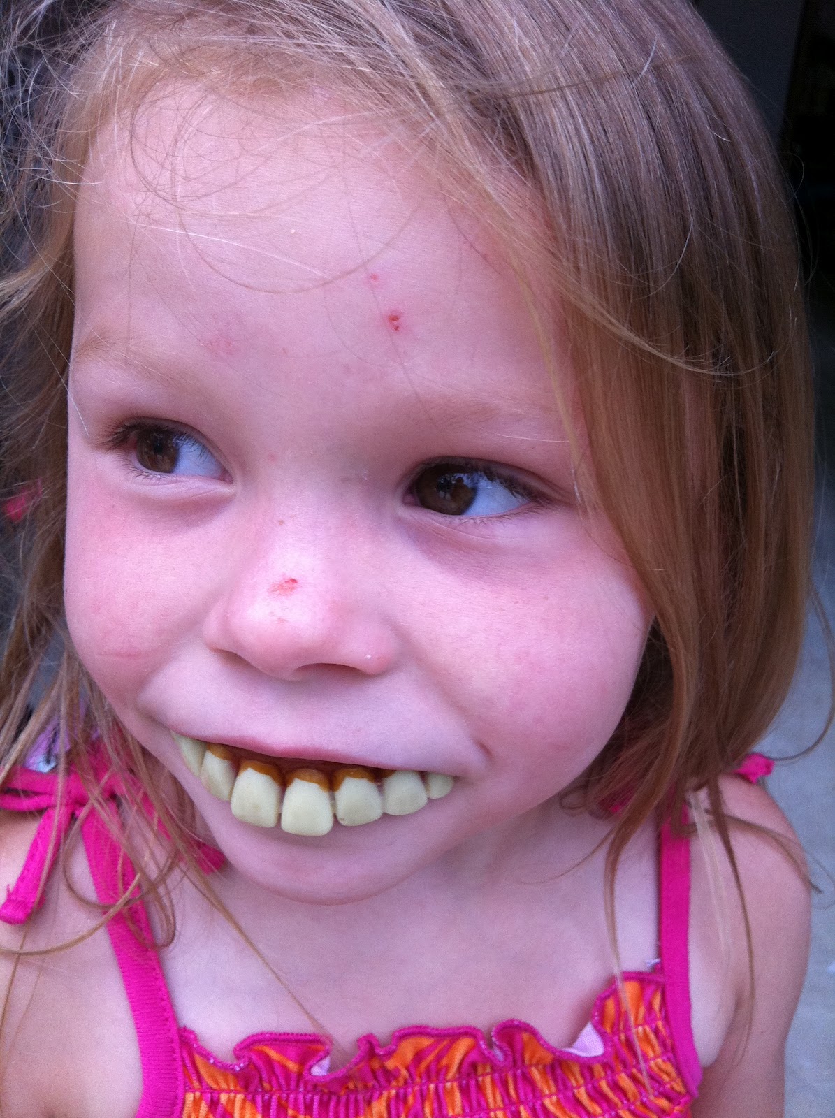 Mojoy: Ellie Sue's buckteeth.