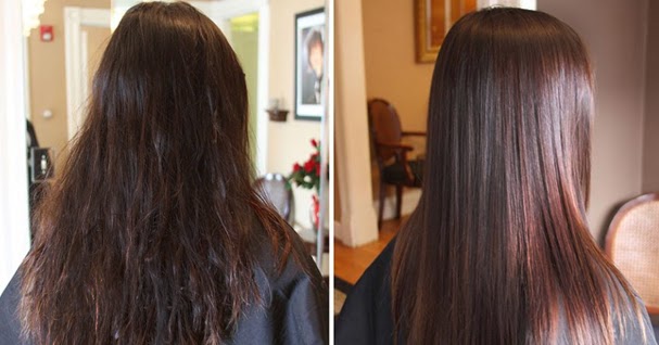 Tricho360 Hair Transplant in Gurgaon, Haryana: Stunning Cysteine Hair ...