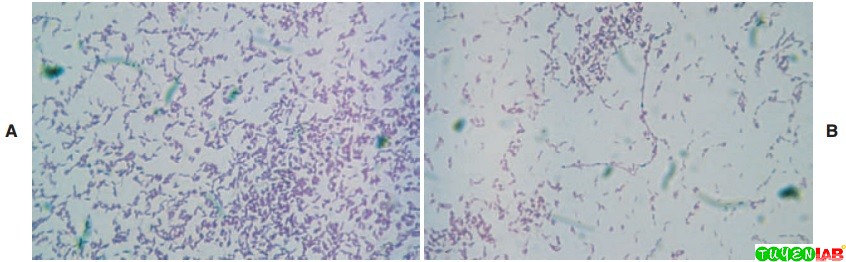 [Microbiology] Atlas of Aerobic Gram-Positive Bacilli | Free Medical Atlas