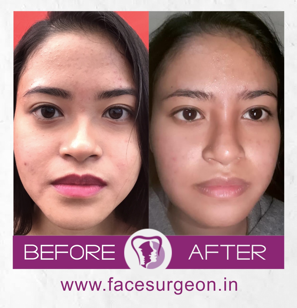 Face Makeover Surgery in South India - Richardson dental and ...