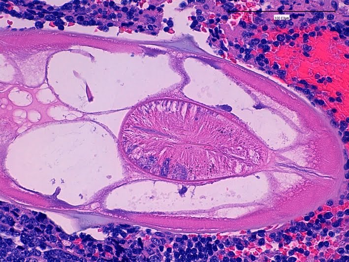 Fun With Microbiology (What's Buggin' You?): Enterobius vermicularis ...