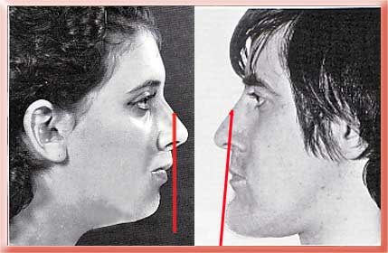 Facial Proportions – Facial Analysis in Cosmetic Surgery
