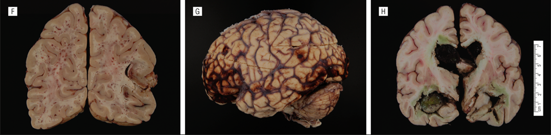 The Neurocritic: The Art of Resurrection