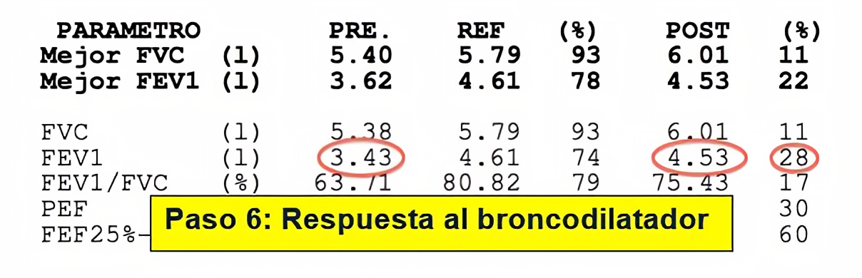 HISTOLOGÍA un enfoque clínico: ESPIROMETRÍA INTERPRETACIÓN BÁSICA