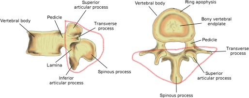 Spondylolysis or Pars Fracture | Growing Spine Blog | Washington ...