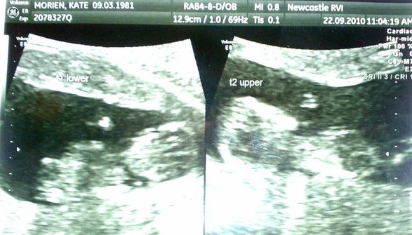 "Are You Sure It Isn't Just A Burger?"