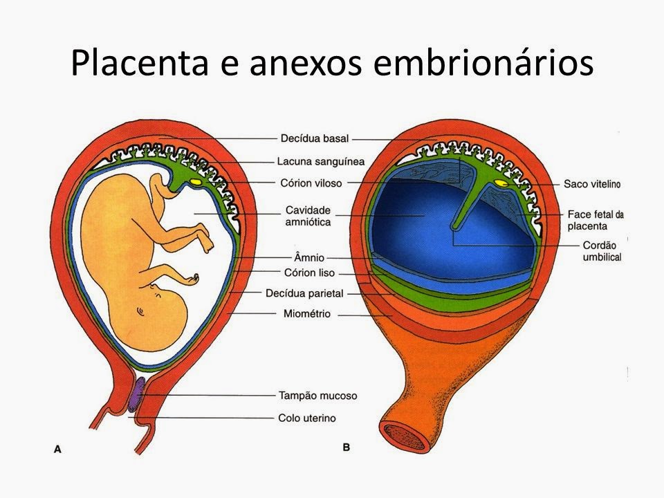 Medicina - facilitando fontes: DESCOLAMENTO PREMATURO DE PLACENTA (DPP)