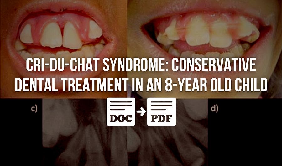 PDF: Cri-du-Chat syndrome: conservative dental treatment in an 8-year ...