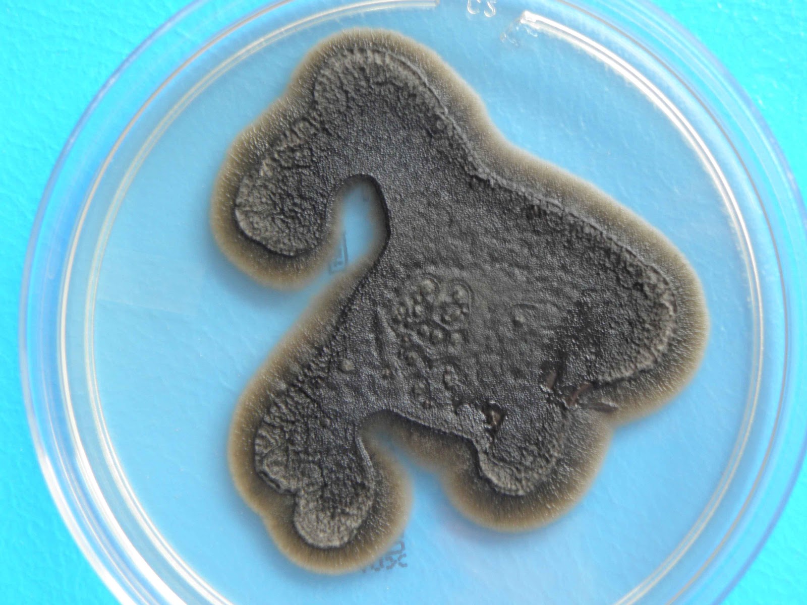 ATLAS MICOLOGIA: EXOPHIALA DERMATITIDIS