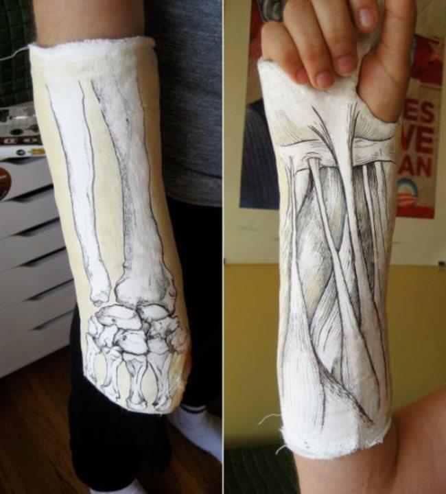 funny things to put on a cast - Creative DIY
