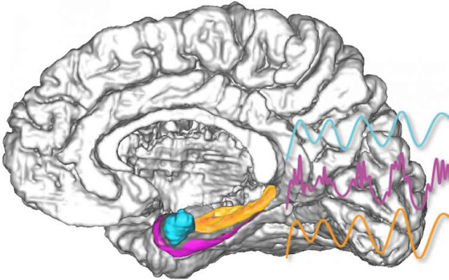 Our Parkinson's Place: Direct Amygdala Stimulation Can Enhance Memory ...