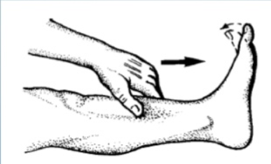 DIPLOMADO AEROMEDICINA : REFLEJOS PATOLOGICOS