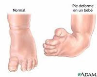 Enfermedades En Bebes