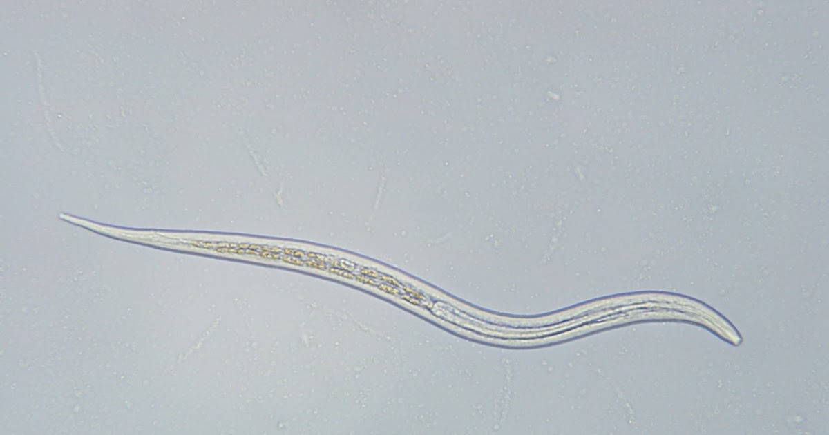 Sciency Thoughts: Strongyloides stercoralis: Determining the origin of ...