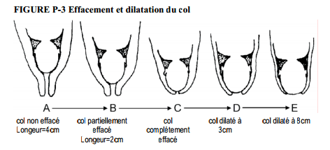 Mettre Au Monde Au Naturel : Effacement et Dilatation du col :phase du ...