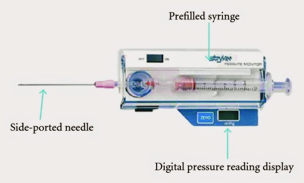 Procedures Club: Compartment Pressure Measurement - "Stryker" It!