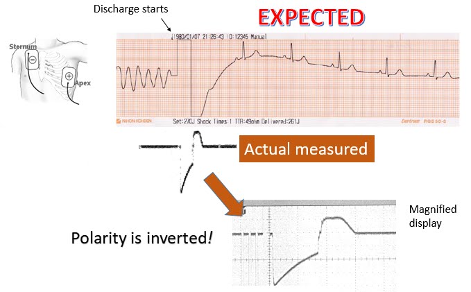 Medical Devices Sanity: CardioLife Acti-Biphasic defibrillation Waveform