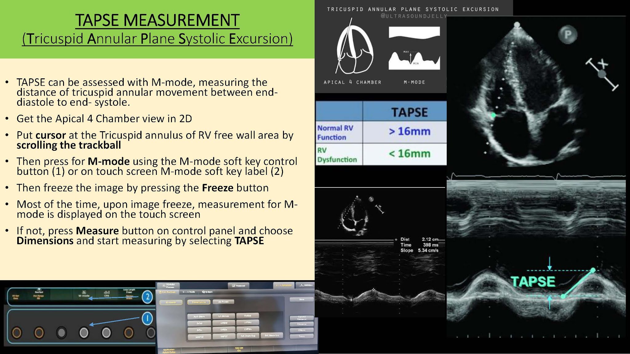 CVT Mohd Farid: Basic Echo Measurements And Values Nurain Jurnalis CVS ...