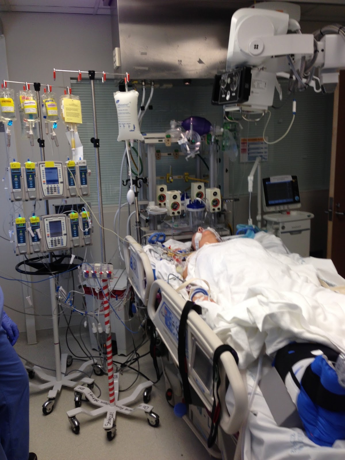 Shirley's Lungs: Photos