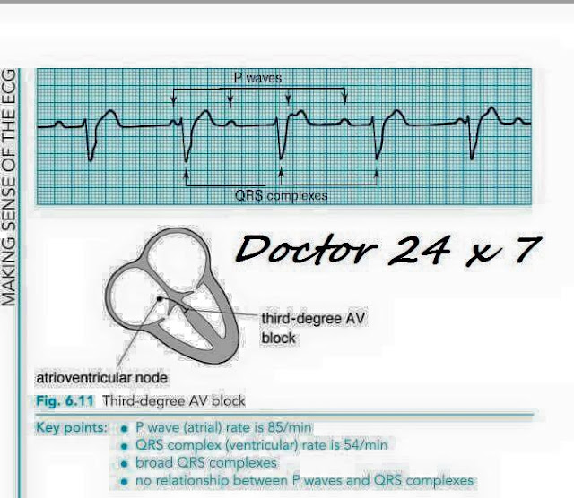amudu: Easy way to learn ECG. Step by Step in a very easy way