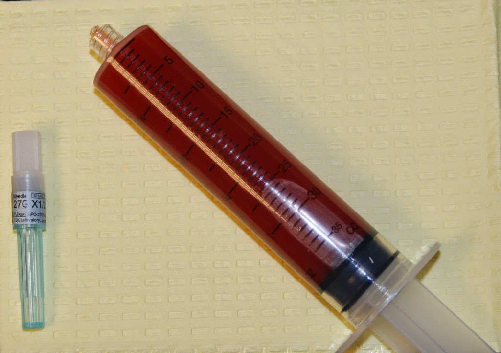 Fight Back: Week 3 Post Mastectomy/Reconstruction Surgery