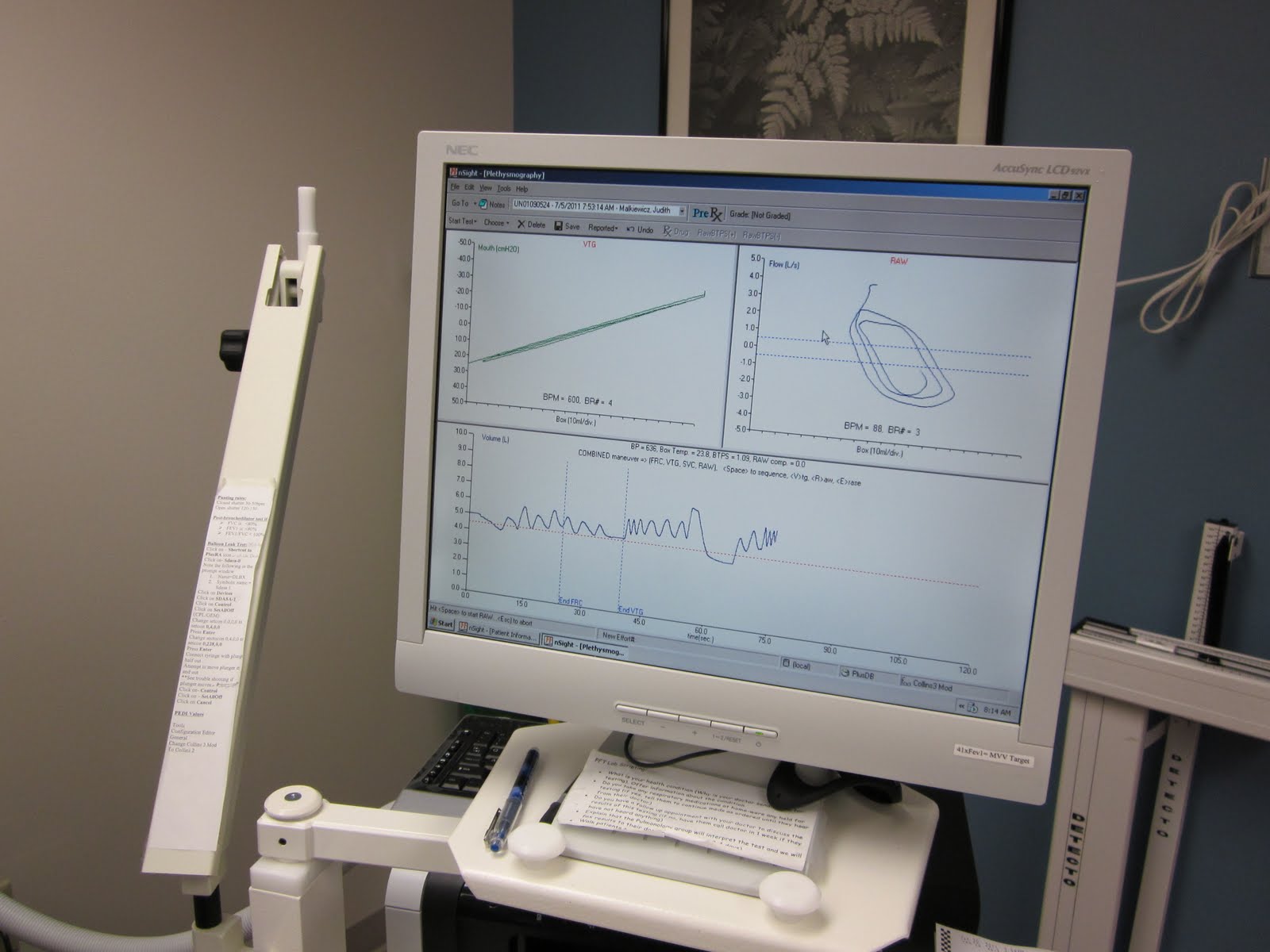 jm's Adventure with Multiple Myeloma: Pulmonary Function Tests at ...