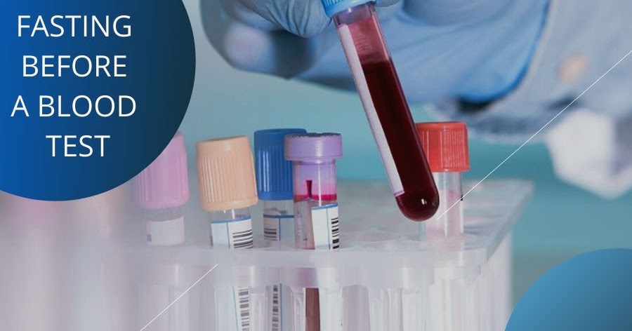 Fasting Before A Blood Test - Swaggy Post - A Practical Blog for ...