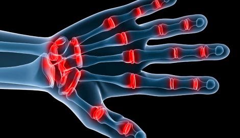 Povrede rucnog zgloba: Anatomija rucnog zgloba