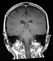 Clippers Mri / Clippers' Paul to have MRI on injured thumb - Metro US ...