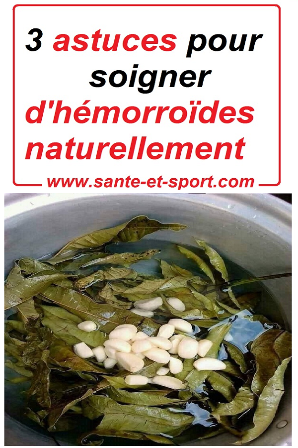 3 astuces pour soigner d'hémorroïdes naturellement ~ Sport et Santé