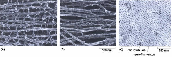 Filamentos Intermedios