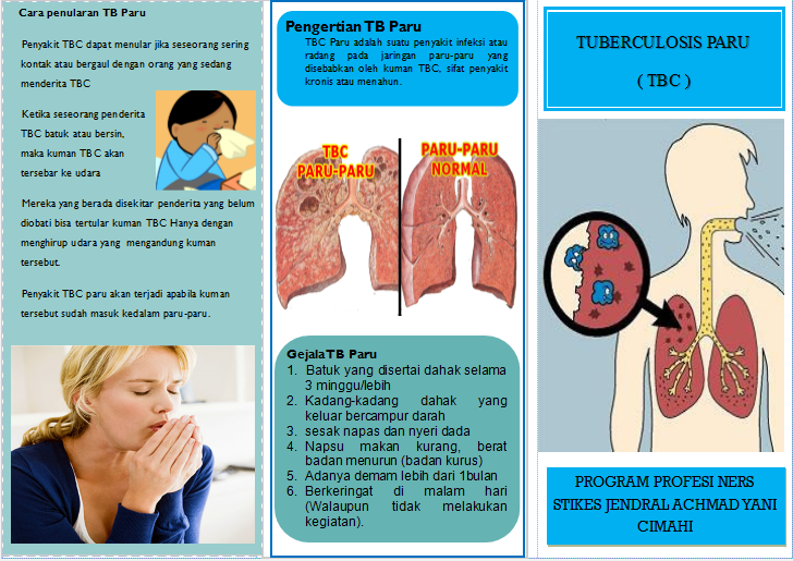 LEAFLET TUBERCULOSIS PARU