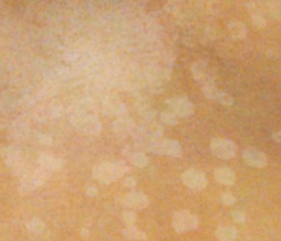 Macam Jamur Kulit - Perumperindo.co.id