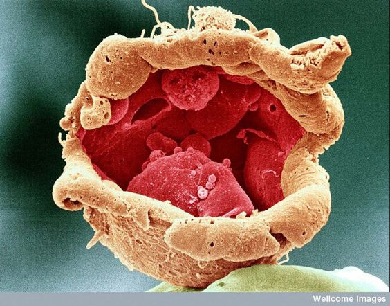 Fertility Biocenter: Single-cell analysis of embryos reveals mis ...