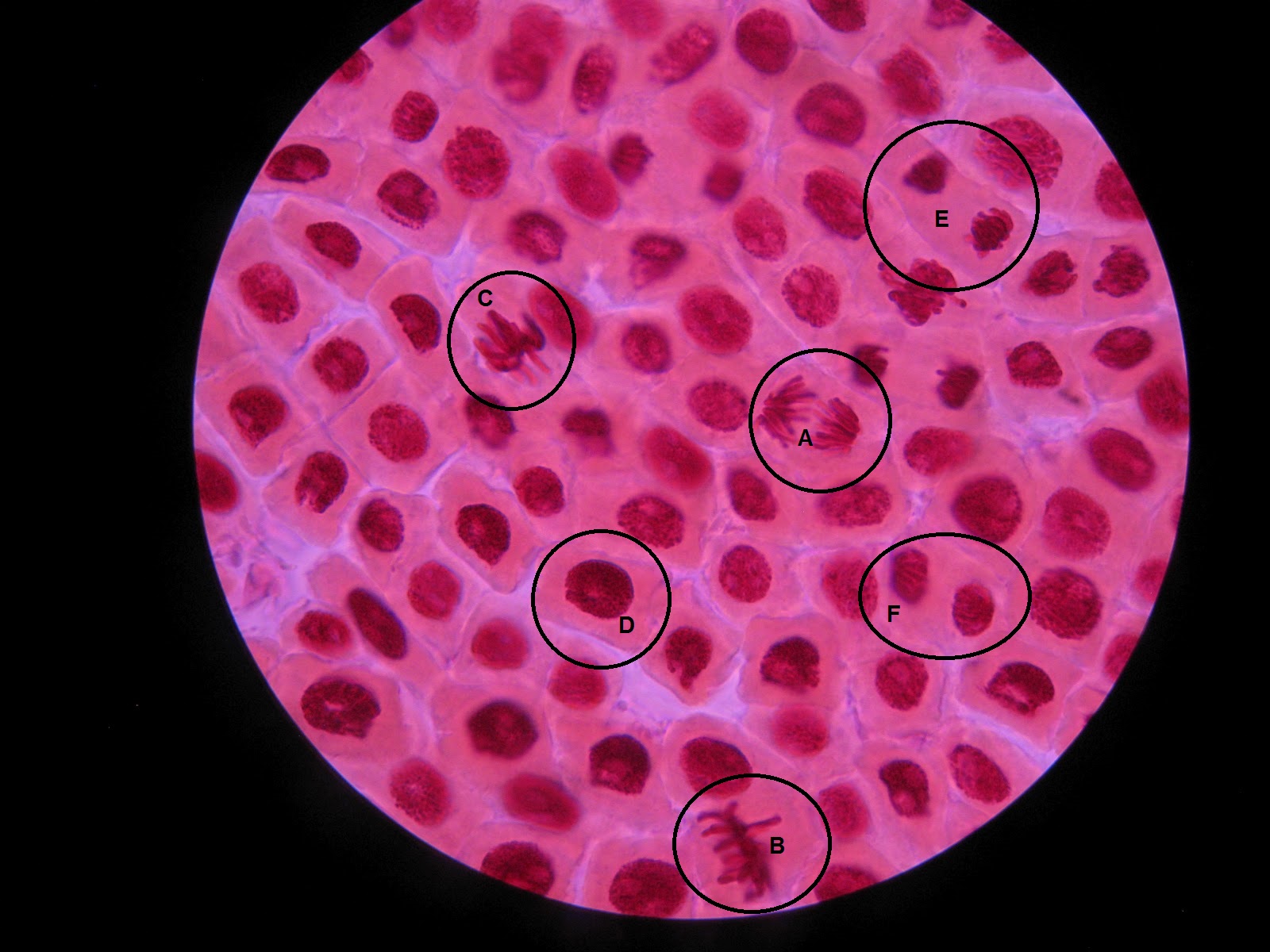 No me toques las Ciencias: 4ESO - Resultados de la práctica: Mitosis.