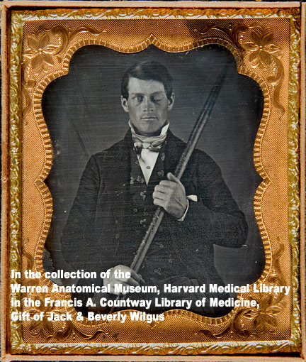 Darwinian Conservatism by Larry Arnhart: Phineas Gage and Damasio's ...