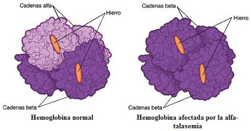 4PM2 Equipo 1 de FSPT: Talasemias