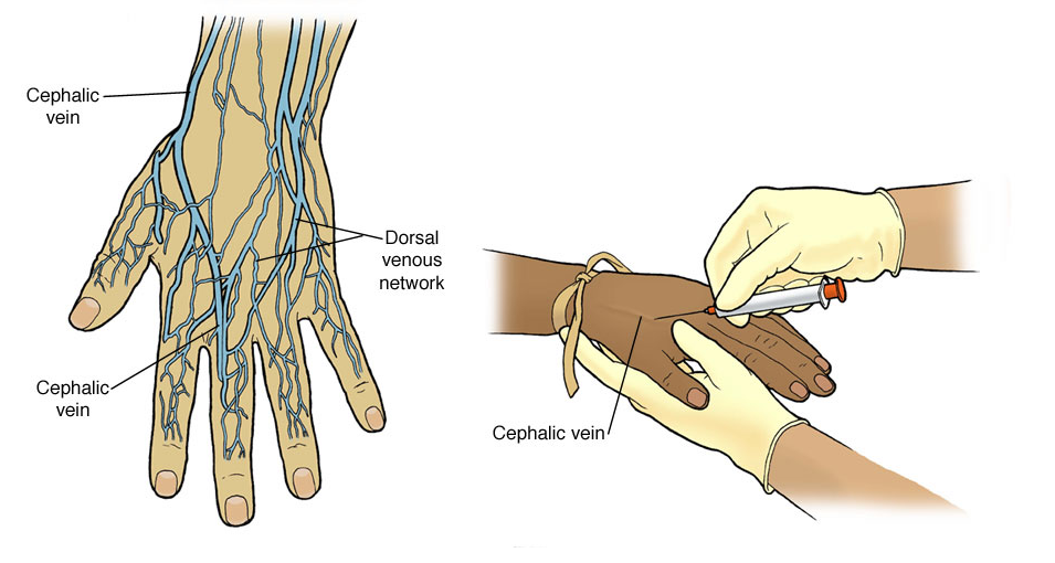 Anatomía 2012 - Ayudante Pablo Prado: Venopunción, Venoclisis y ...