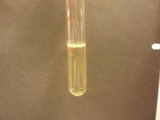 MicrobeDiscoveries: Oxygen Requirements Lab Results and Starch, Lipid ...